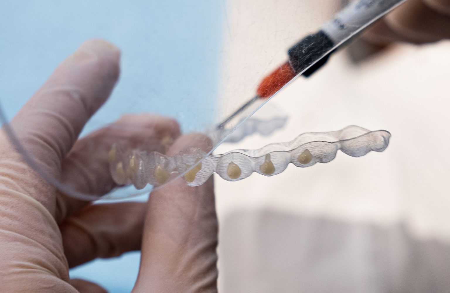 ¿Qué función tienen los ataches en Invisalign? | Instituto IO Oliver